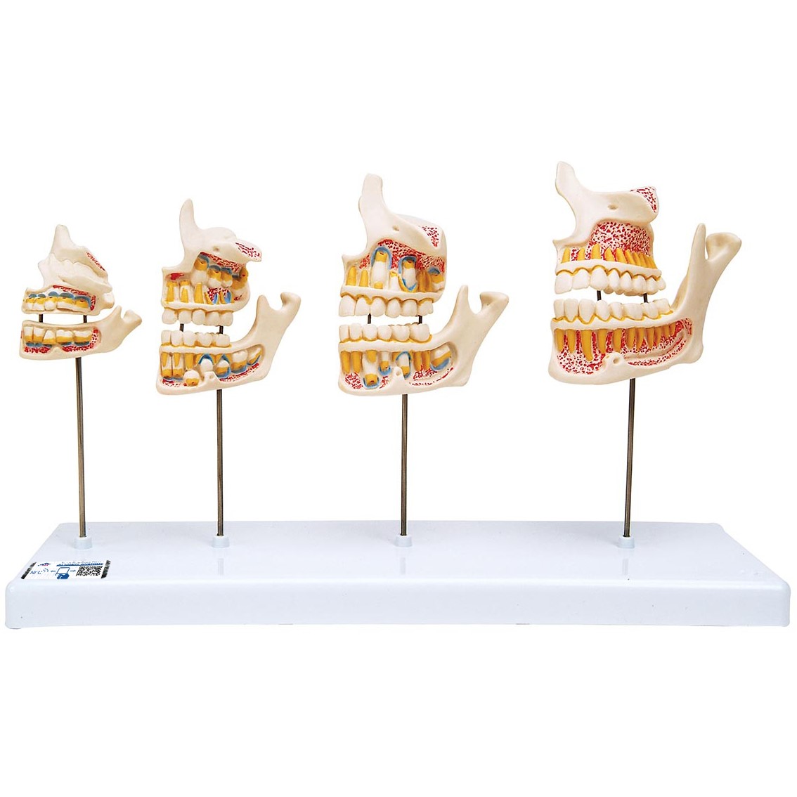 UK 3B Dentition Development | HCE