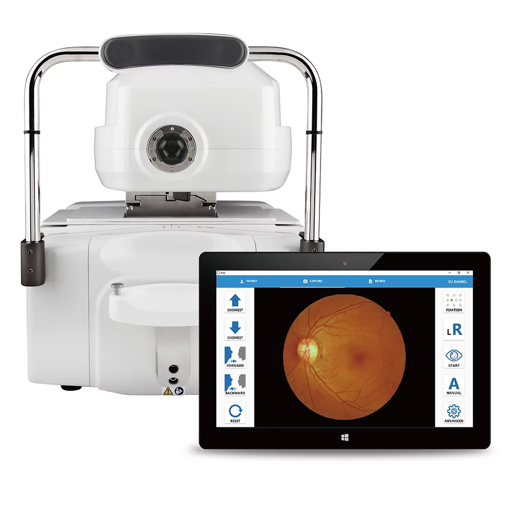 NFC-600 Portable Automatic Non-mydriatic Retinal Camera | HCE