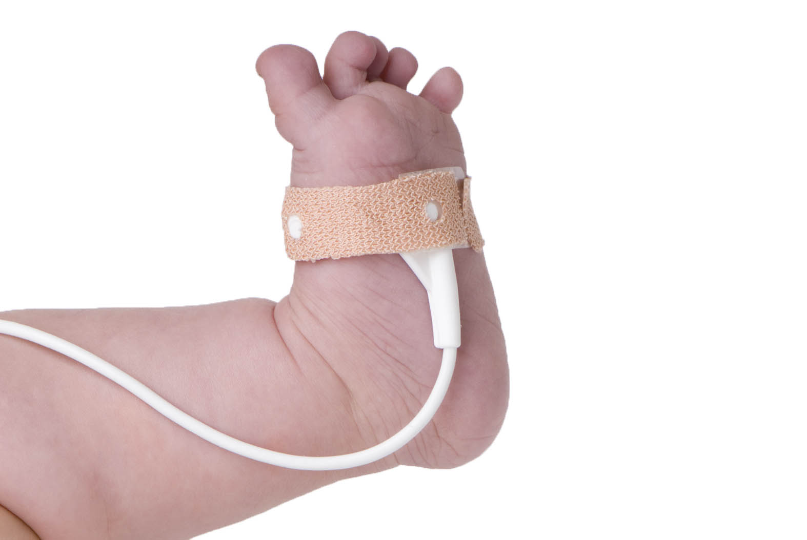 MiniPulse Neonatal Wrap Sensor