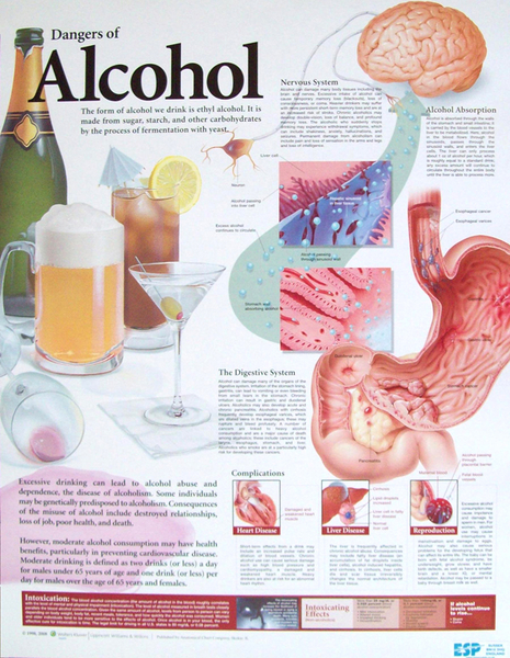 Dangers Of Alcohol Wall Chart | HCE