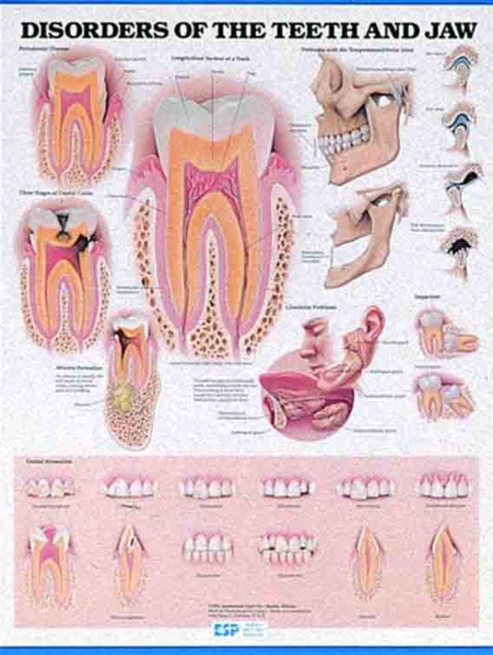 Disorders Of Teeth & Jaw Wall Chart | HCE