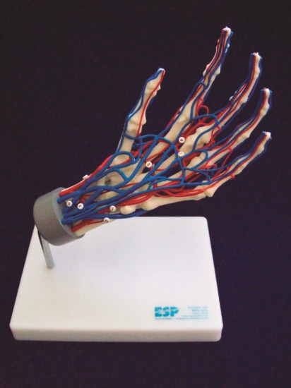 ESP Vascular Hand Model | HCE
