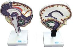 ESP Cerebrospinal Fluid Circulation Model | HCE