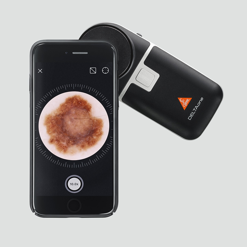 CLEARANCE - HEINE Universal Smartphone Adaptor DELTAone Dermatoscope | HCE