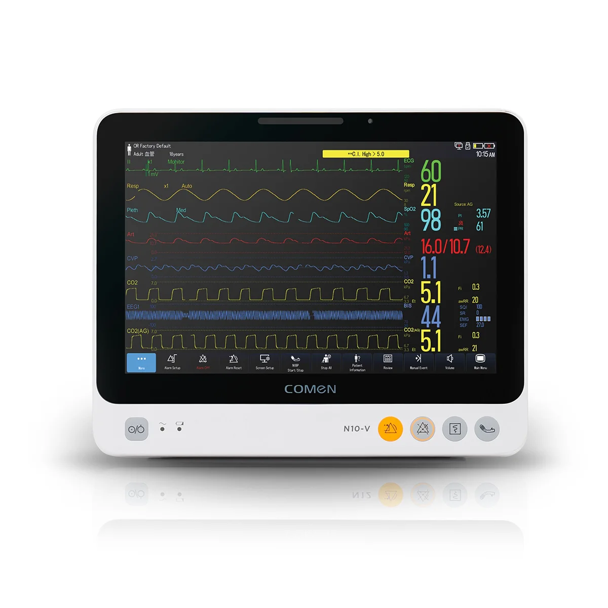 Comen N10-V Veterinary Patient Monitor | HCE Vets Equipment