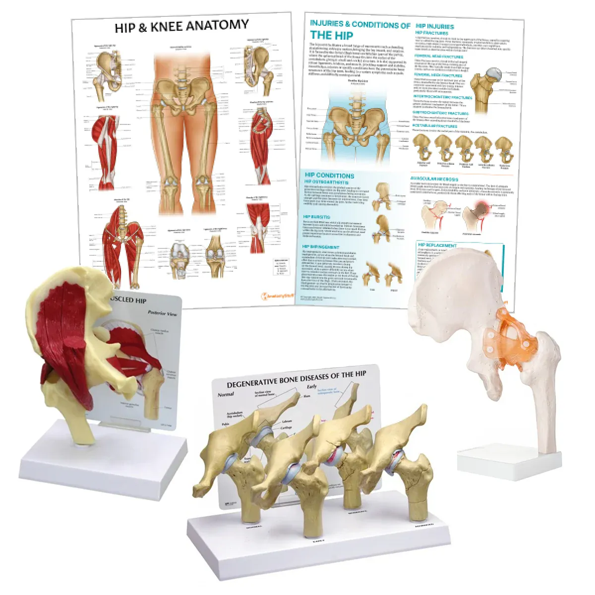 Hip Anatomy & Pathology Collection | HCE