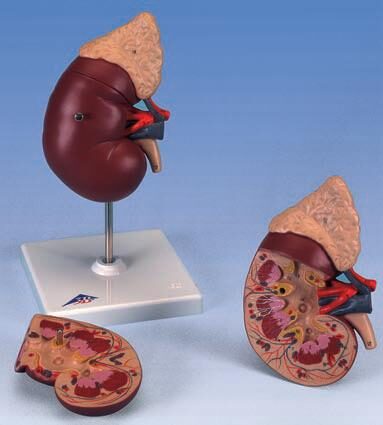 UK 3B Kidney Stone Model | HCE
