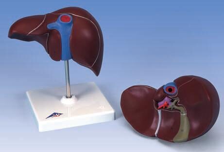 UK 3B Gallstone Model | HCE