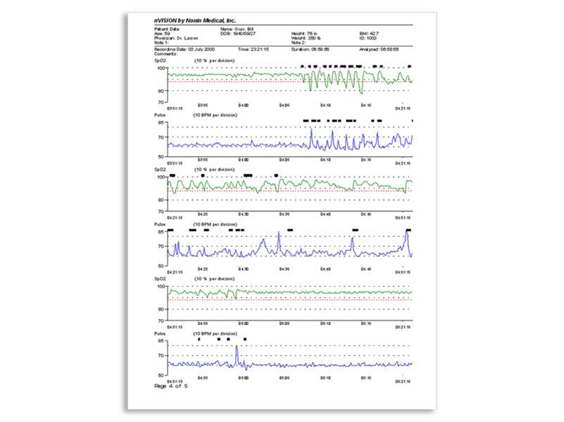 Nonin nVision PC Software for 3150 WristOx2 Monitor | HCE