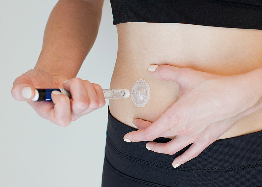 Medtronic i-Port Advance Injection Port | HCE