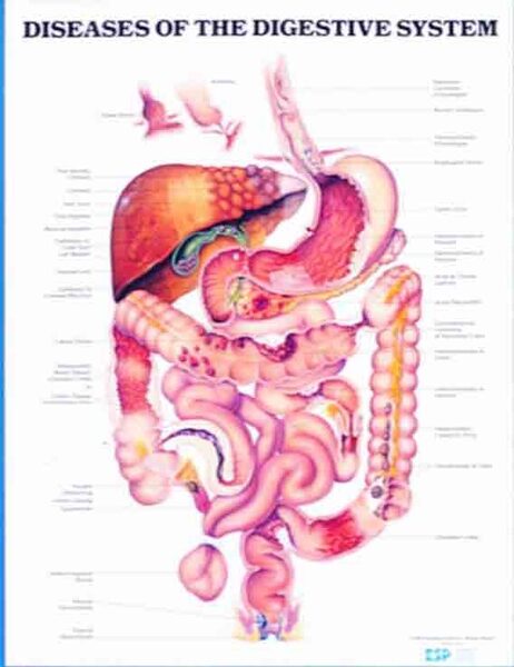 Diseases Of The Digestive System Wall Chart | HCE