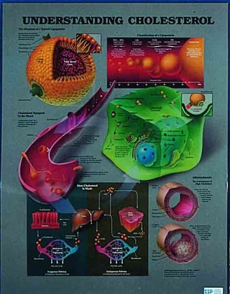 Understand Cholesterol Wall Chart | HCE