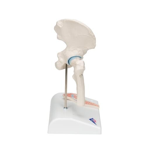 UK 3B Mini Hip Joint with cross-section on base | HCE