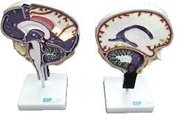 ESP Cerebrospinal Fluid Circulation Model | HCE