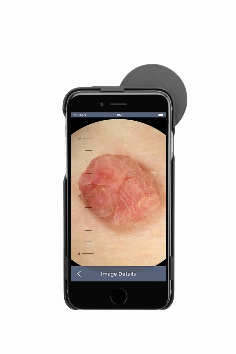 HEINE iC1 Dermatoscope iC1/7 for iPhone 7 & 8 | HCE