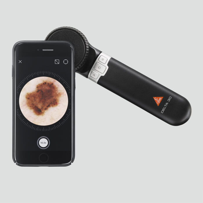 CLEARANCE - HEINE Universal Smartphone Adaptor DELTAone Dermatoscope | HCE