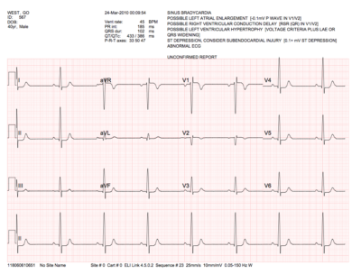 Welch Allyn Mortara ELI150c Resting ECG | HCE Medical Equipment