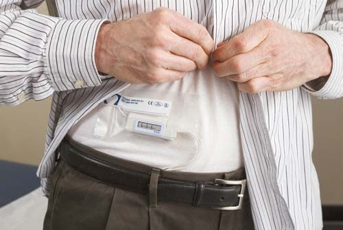 Welch Allyn H3+ 7-Day Digital Holter ECG Recorder | HCE