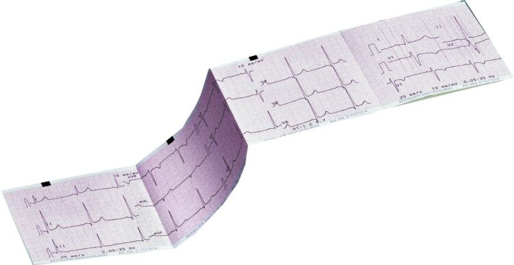 Schiller AT-10 Plus Paper | HCE