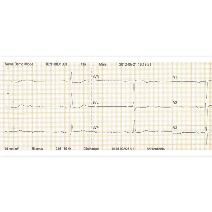 Mindray Thermal Recorder Paper Roll | HCE