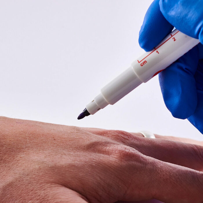 Schuco Single-Use Non-Sterile Surgical Skin Markers (100 Pack) | HCE