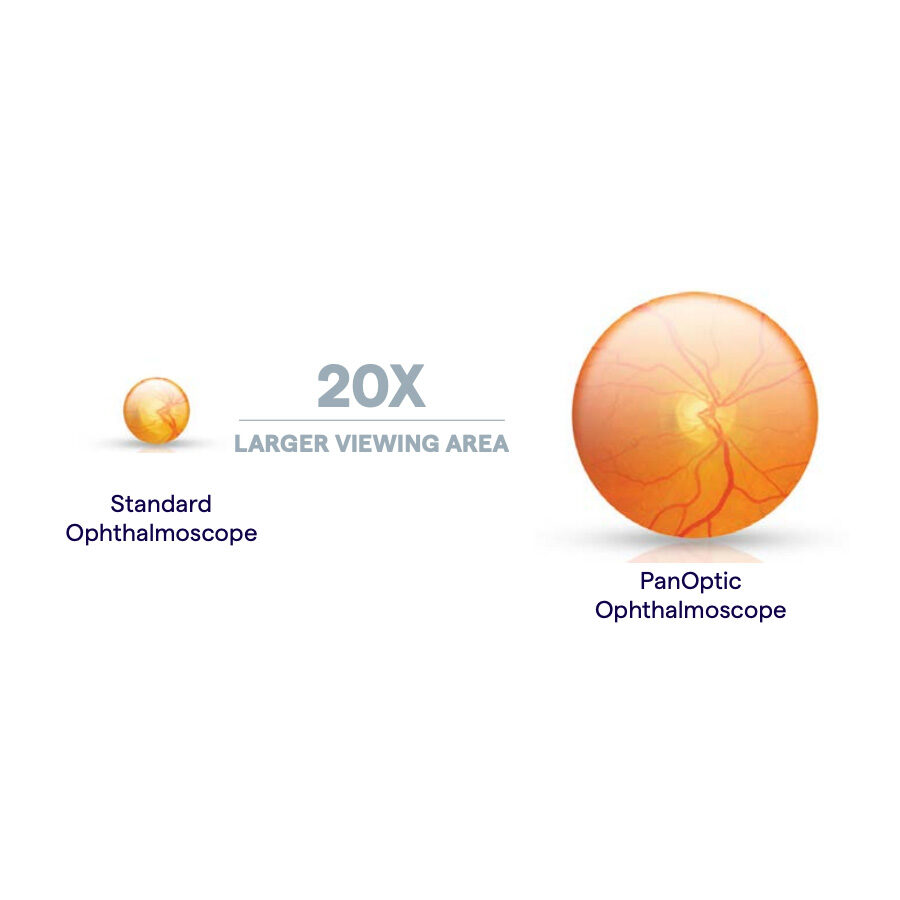 Welch Allyn PanOptic Plus LED Ophthalmoscope Head (118-2)