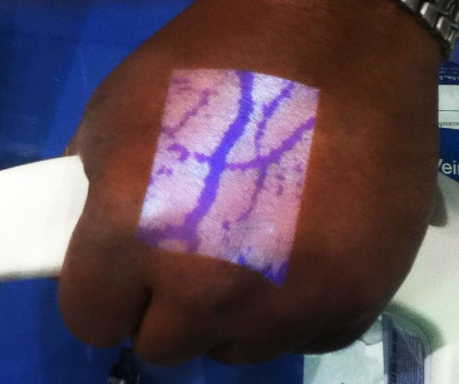 Vein Viewer - Infrared Vein Finder | HCE