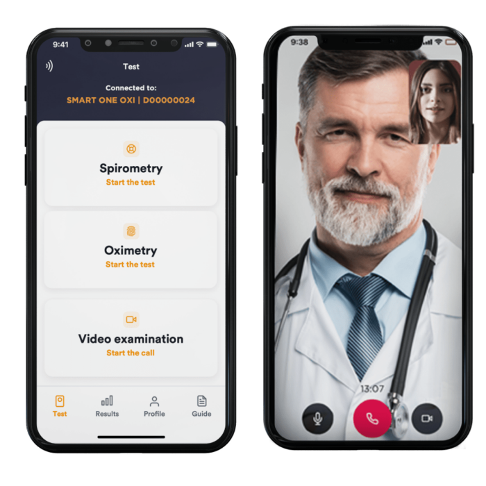 MIR Spirobank Smart Oxi Spirometer with SVC enabled | HCE